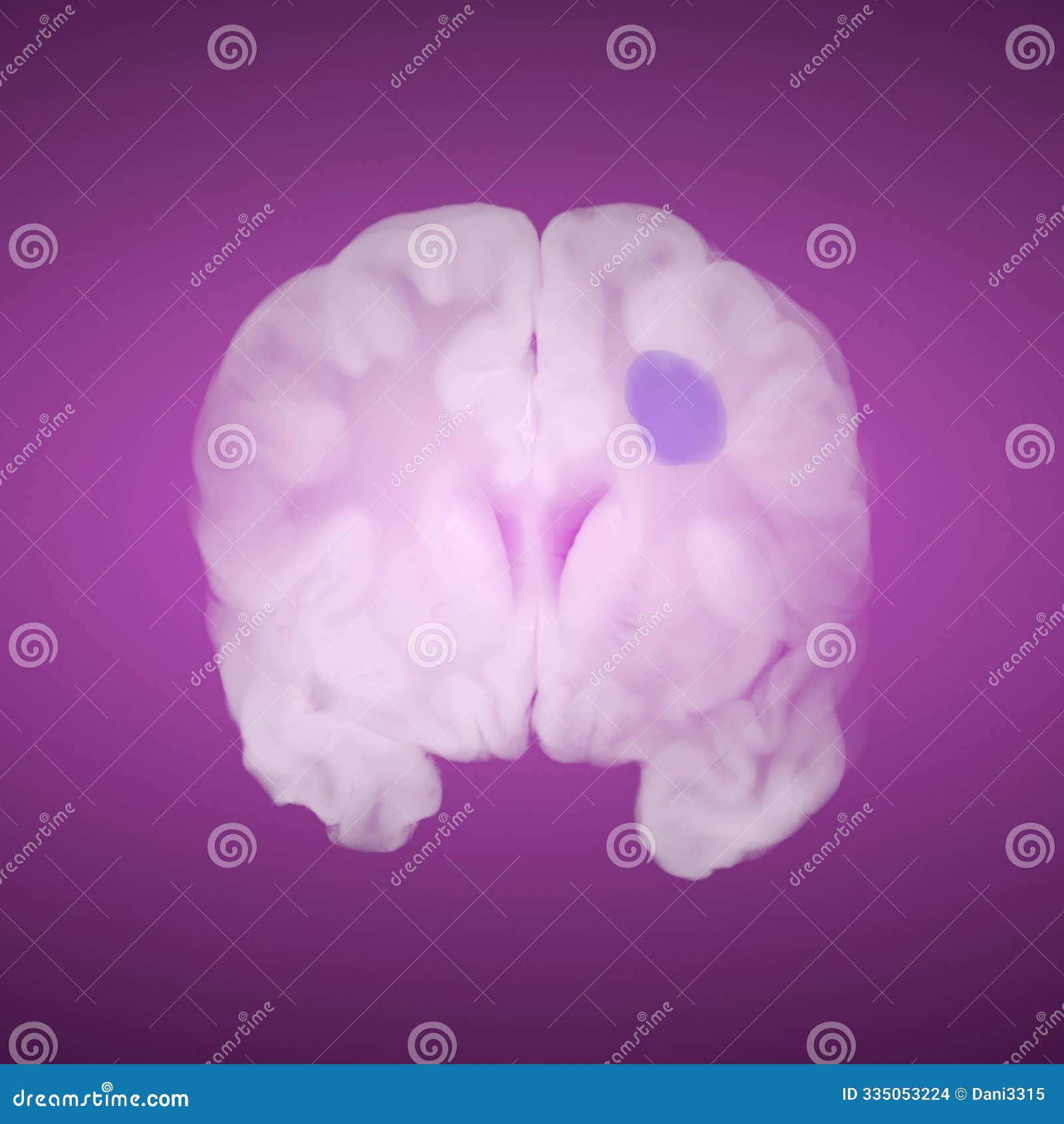 Top View Brain Slice Isolated On White Background. Concept For ...