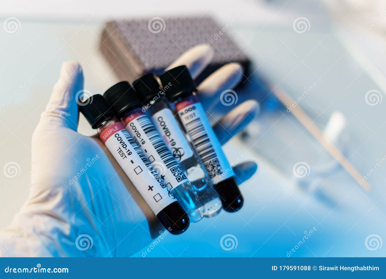 Coronavirus Testing Process, a Hand Holds Tube of Blood Test Samples ...