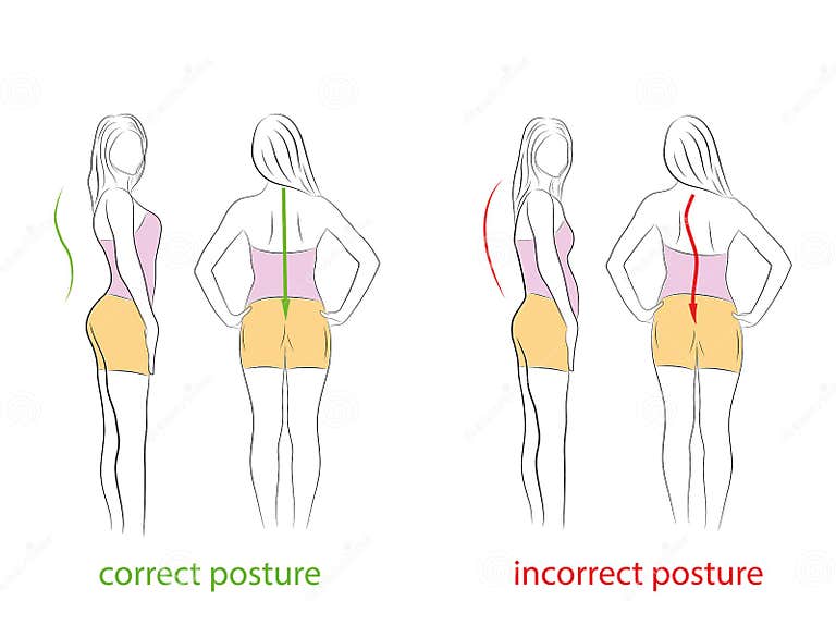 Correct and Incorrect Posture. Side and Rear View. Medical ...