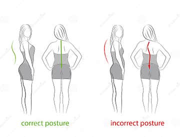 Correct and Incorrect Posture. Side and Rear View. Medical ...