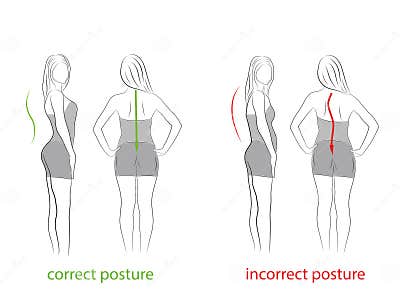 Correct and Incorrect Posture. Side and Rear View. Medical ...