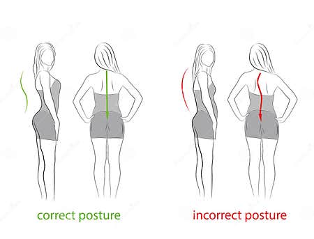 Correct and Incorrect Posture. Side and Rear View. Medical ...