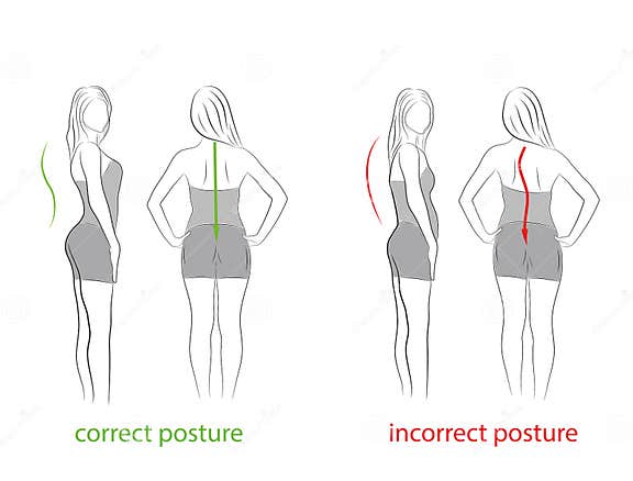 Correct and Incorrect Posture. Side and Rear View. Medical ...