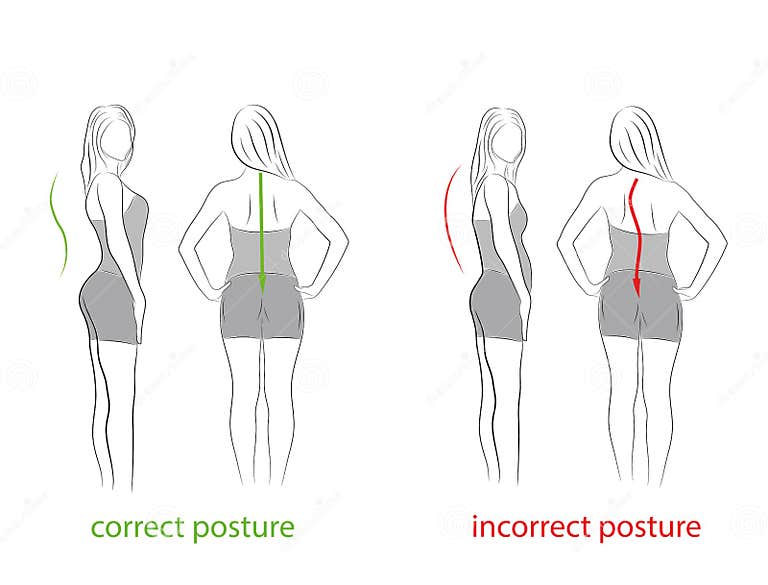 Correct and Incorrect Posture. Side and Rear View. Medical ...