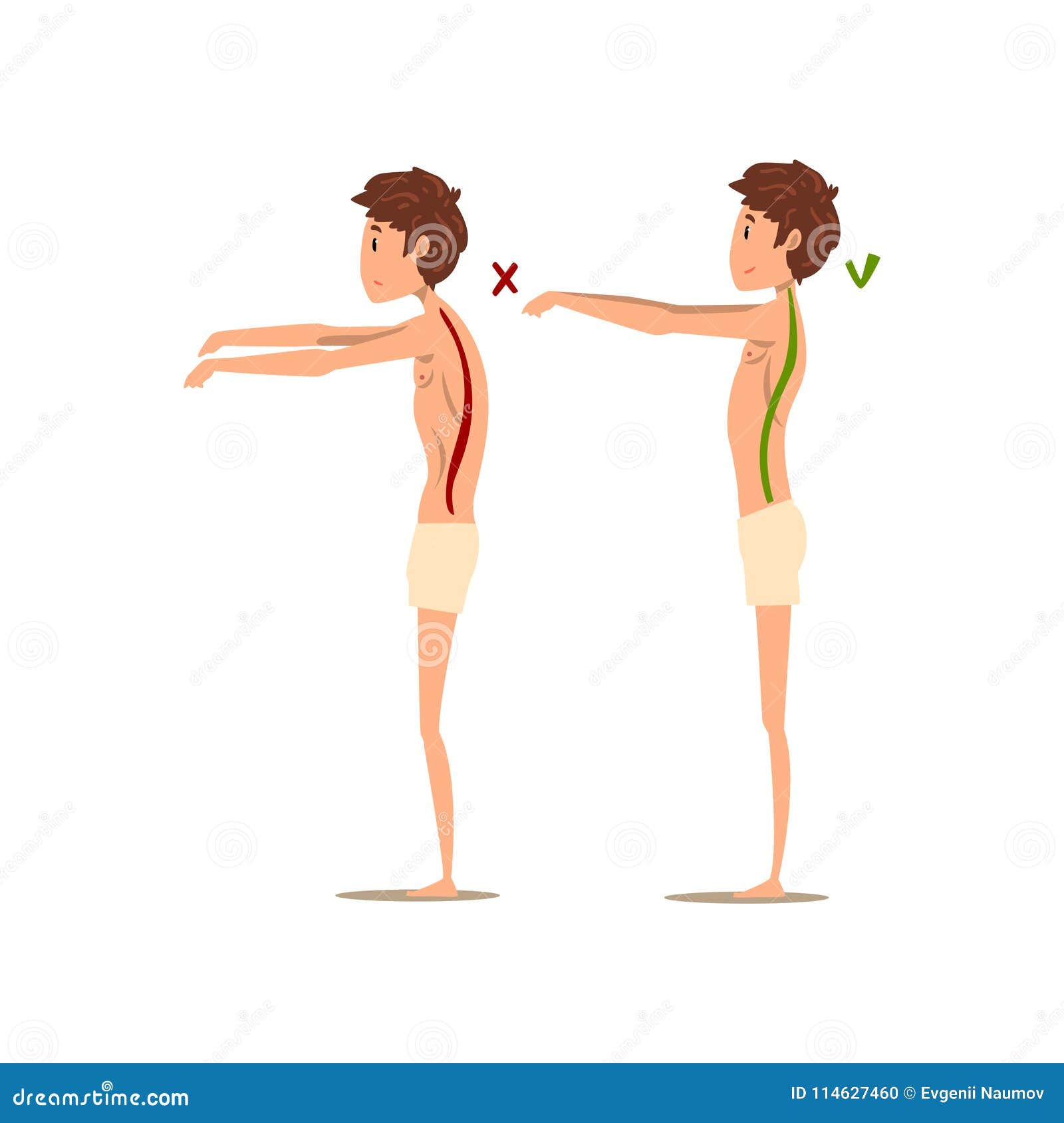 Correct and Wrong Spine Posture, Side View Vector Illustration on a ... Correct and Wrong Spine Posture, Side View Vector Illustration on a ...