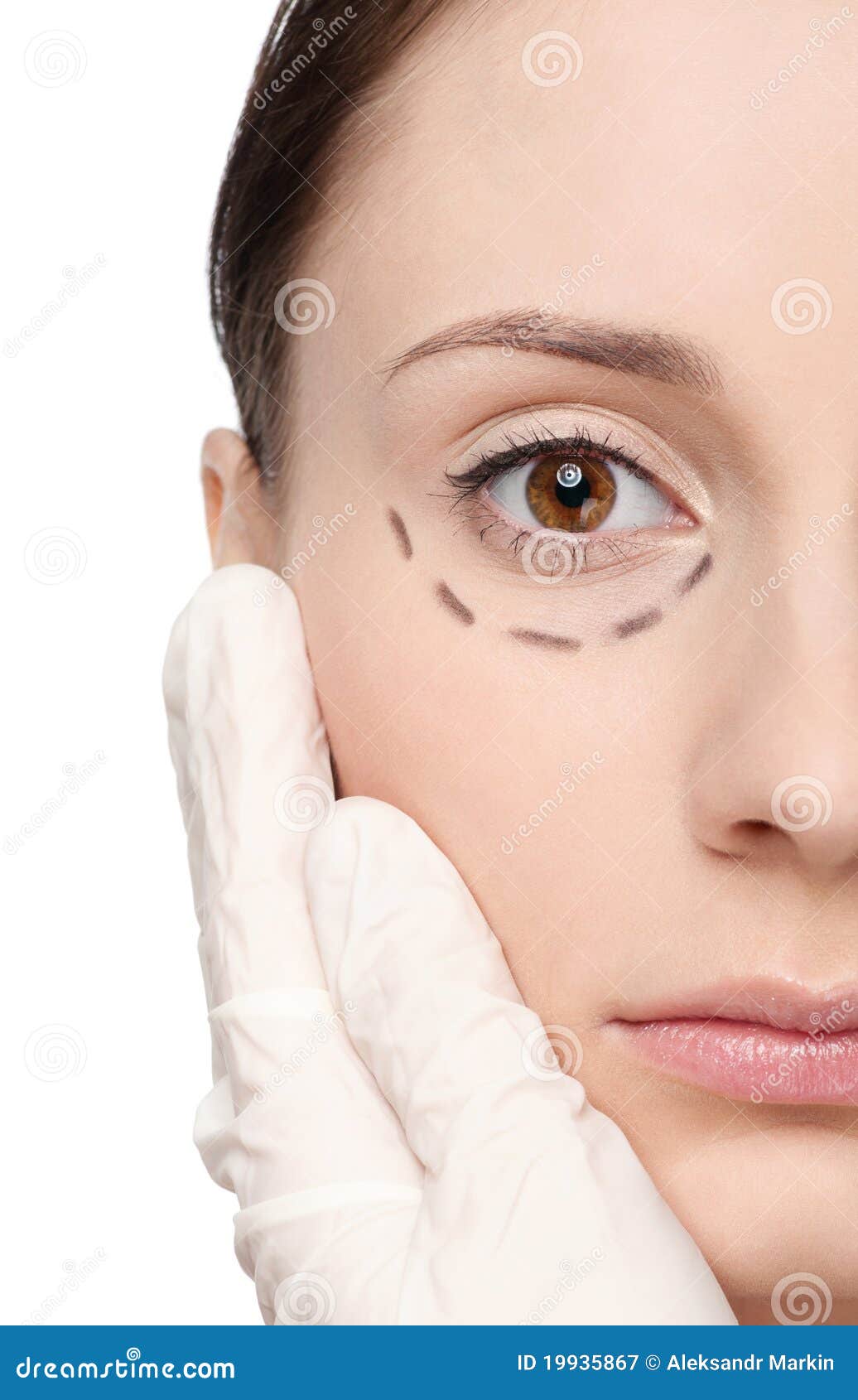 Correction Lines on Woman Face Stock Image - Image of medicine ...