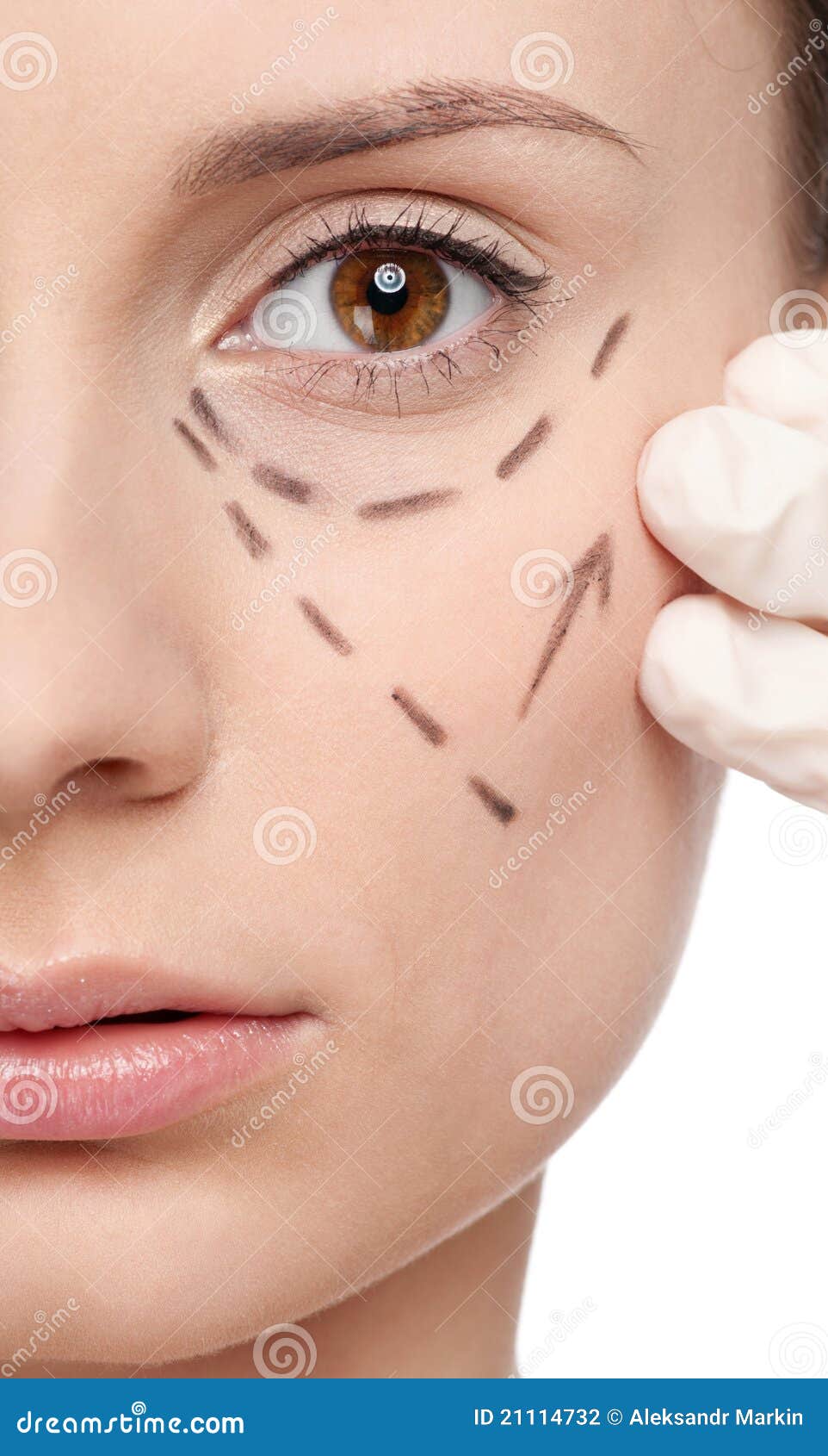 Correction Lines On Woman Face Stock Photo - Image of perfect, adult ...