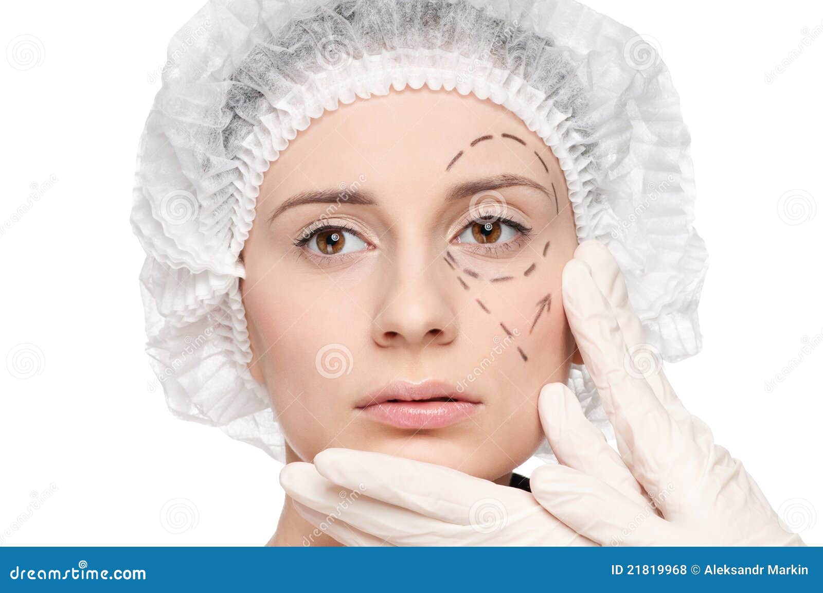 Correction Lines on Woman Face Stock Photo - Image of clean, aesthetic ...