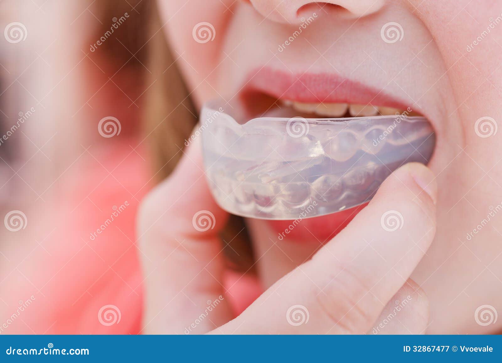 Correction of Tooth Bite by Orthodontic Trainer Stock Image - Image of ...