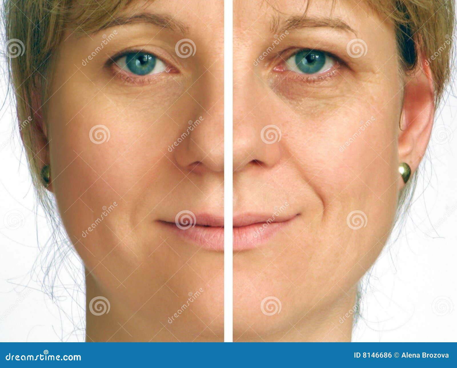 Correction of Wrinkles - Half of Face Stock Photo - Image of beauty ...