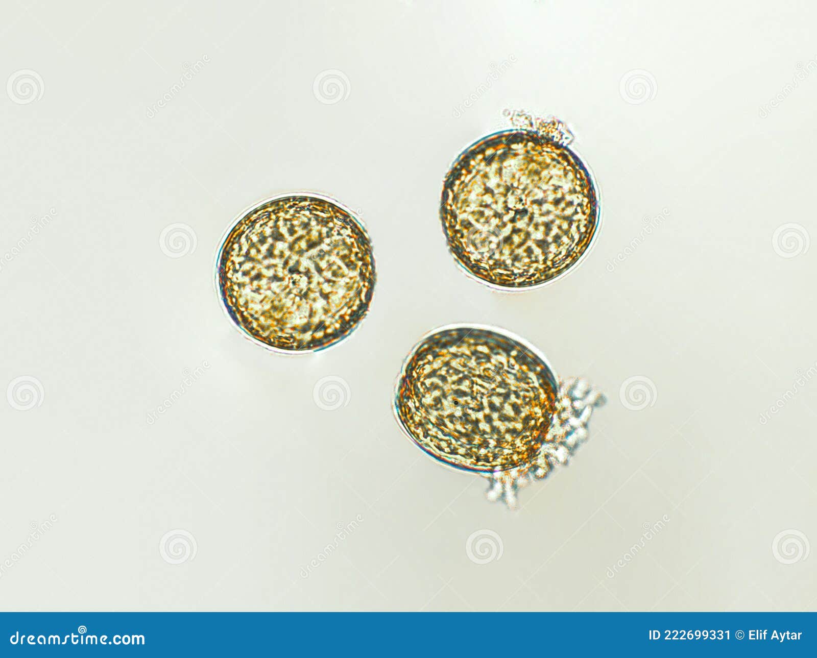 Coscinodiscus Sp. Algae Under Microscopic View Stock Image - Image of ...