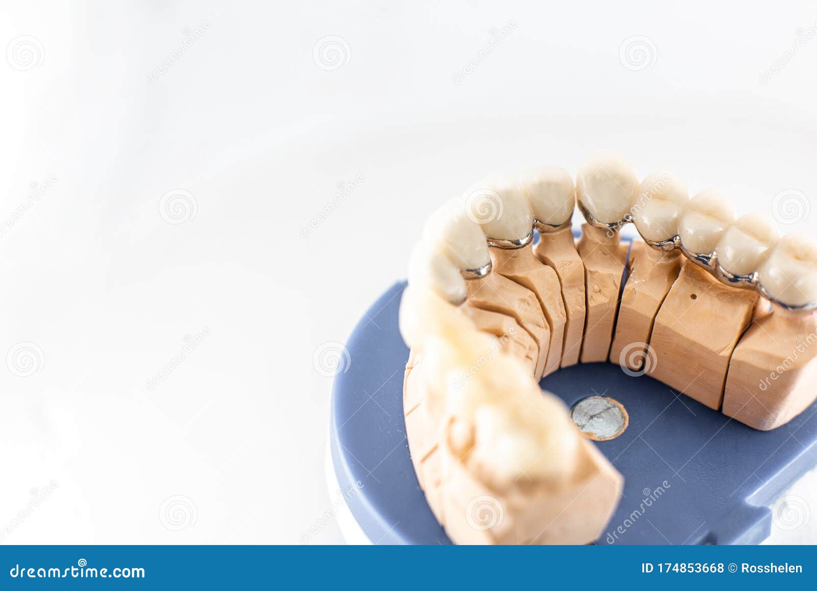 Dental Imprint with Artificial Teeth Stock Photo - Image of gypsum ...