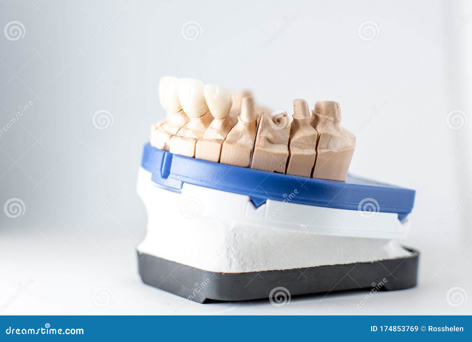 Dental Imprint with Artificial Teeth Stock Image - Image of making ... Dental Imprint with Artificial Teeth Stock Image - Image of making ...