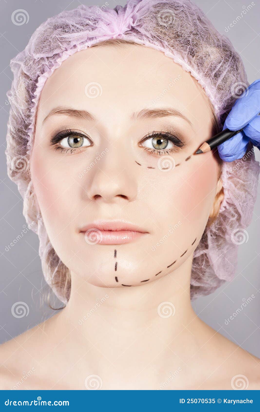 Cosmetic Botox Injection, in the Female Face. Stock Image - Image of ...