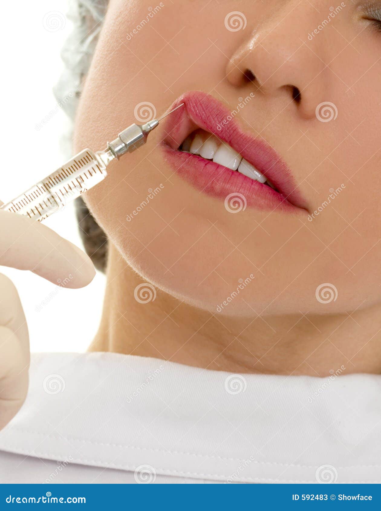 Cosmetic Surgery - Lip Augmentation Stock Image - Image of mouth, body ...