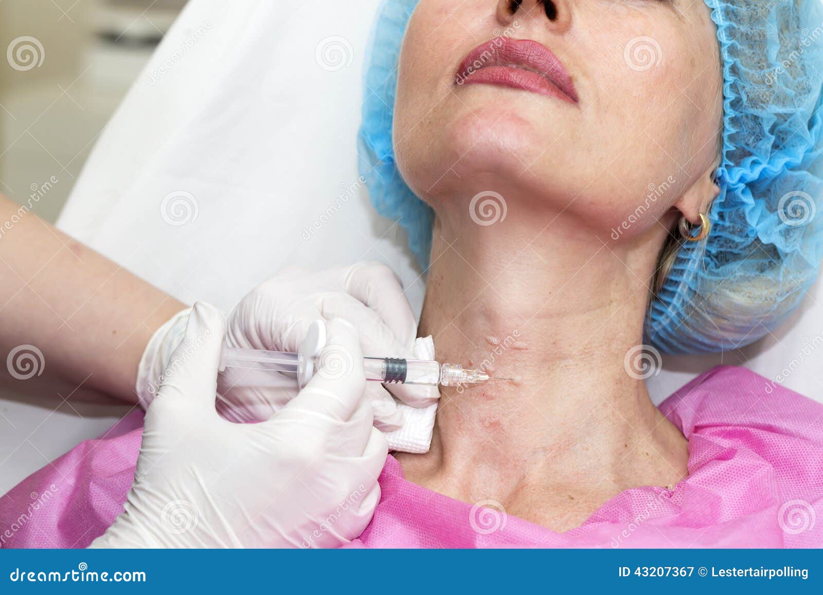 Cosmetic surgery stock image. Image of injection, surgery - 43207367