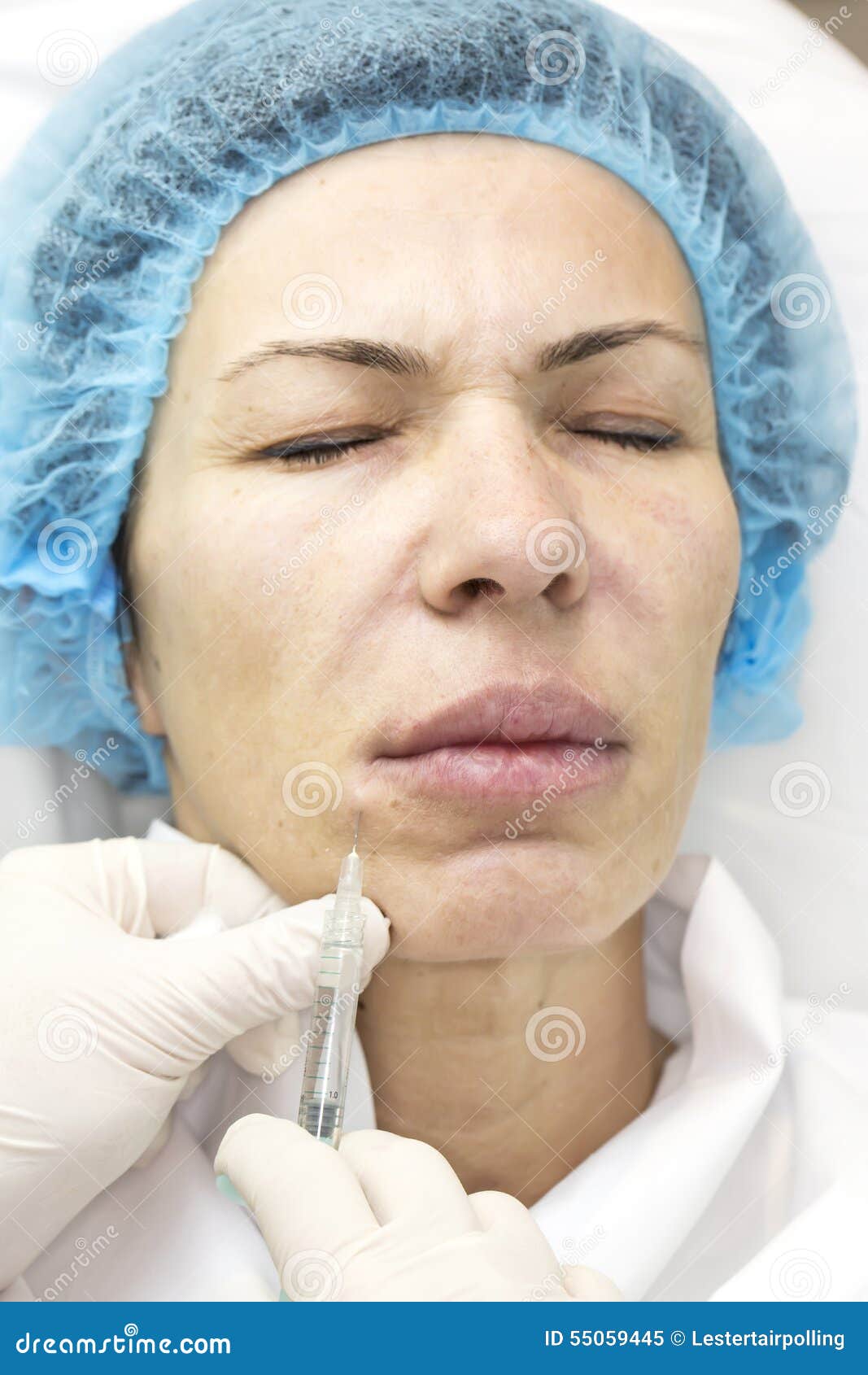 Cosmetic surgery stock image. Image of surgery, collagen - 55059445
