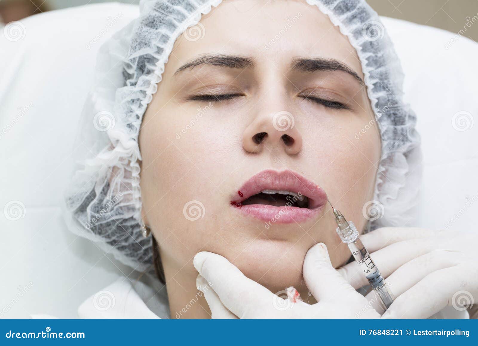 Cosmetic Treatment with Injection Stock Image - Image of needle, care ...