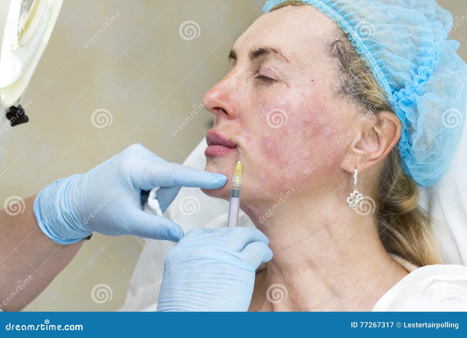 Cosmetic Treatment with Injection Stock Image - Image of liquid ...