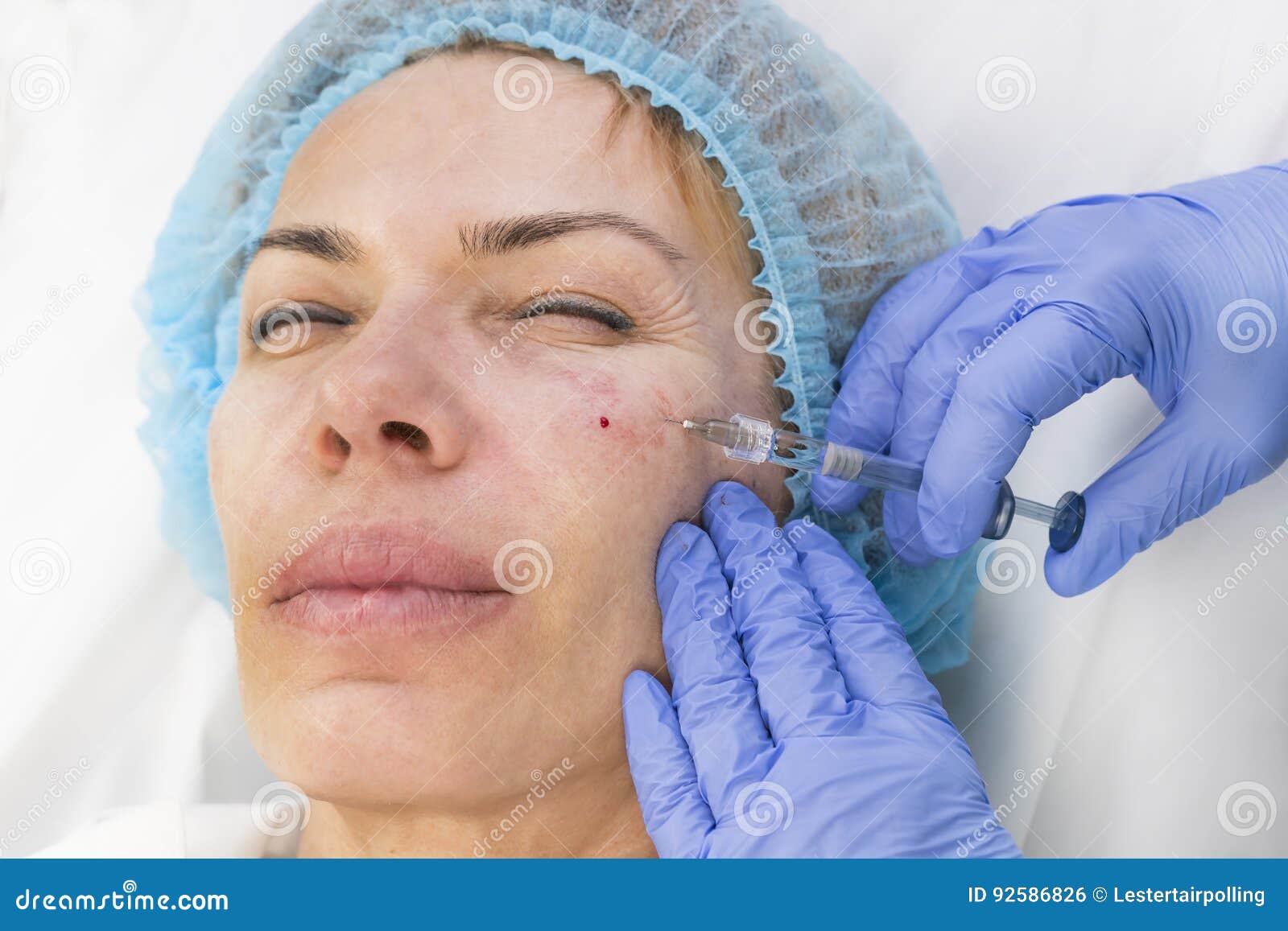 Cosmetic Treatment with Injection Stock Photo - Image of doctor ...
