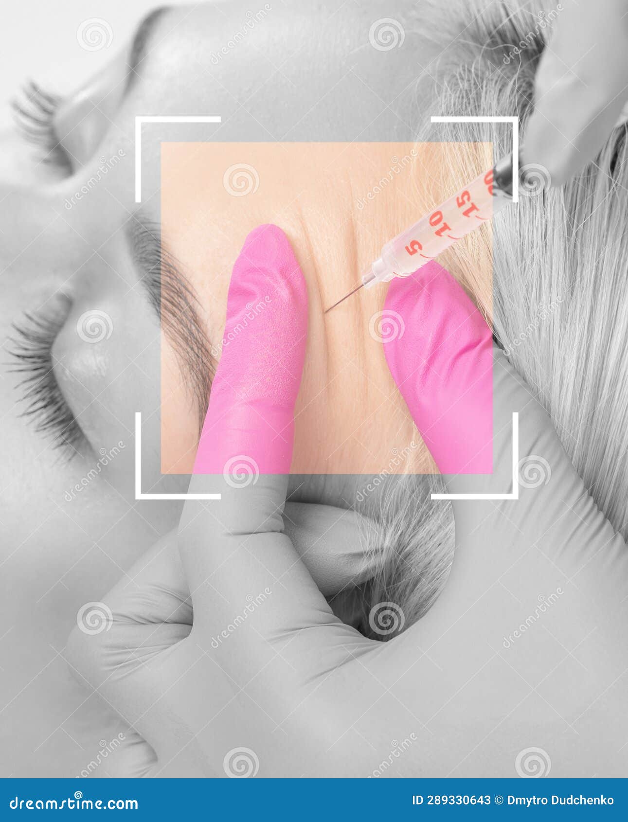Cosmetologist Makes Rejuvenating Anti Wrinkle Injections On The Face Of