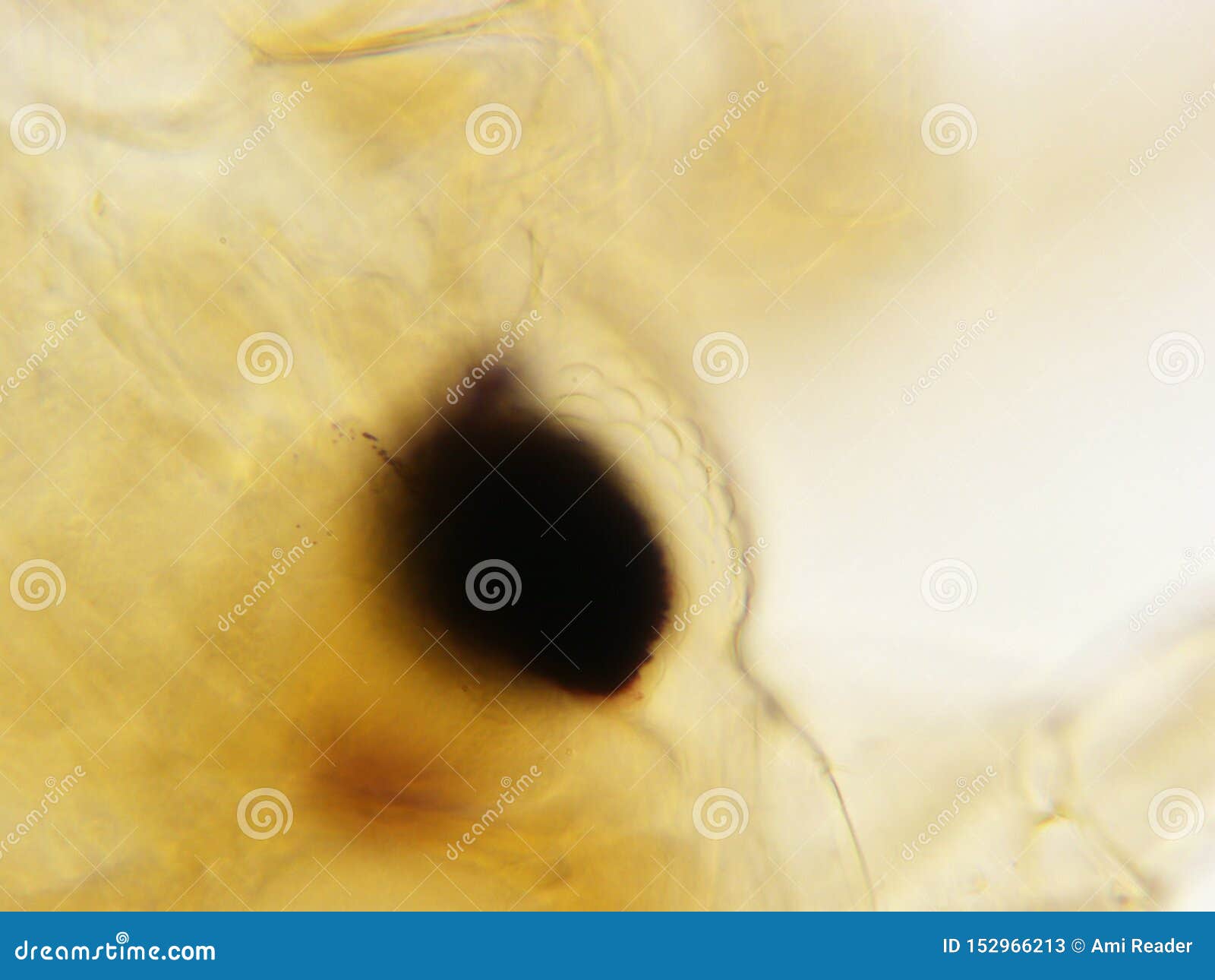 Cotton Worm Eye 400x Magnification Stock Image - Image of side ...