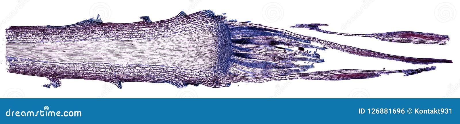 Coupe Microscopique De Section Transversale De Mousse Sous Le ...