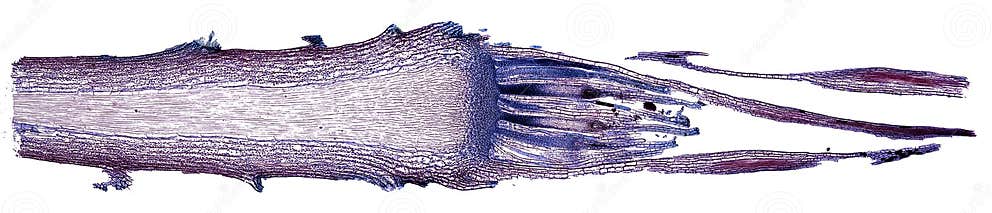 Coupe Microscopique De Section Transversale De Mousse Sous Le ...