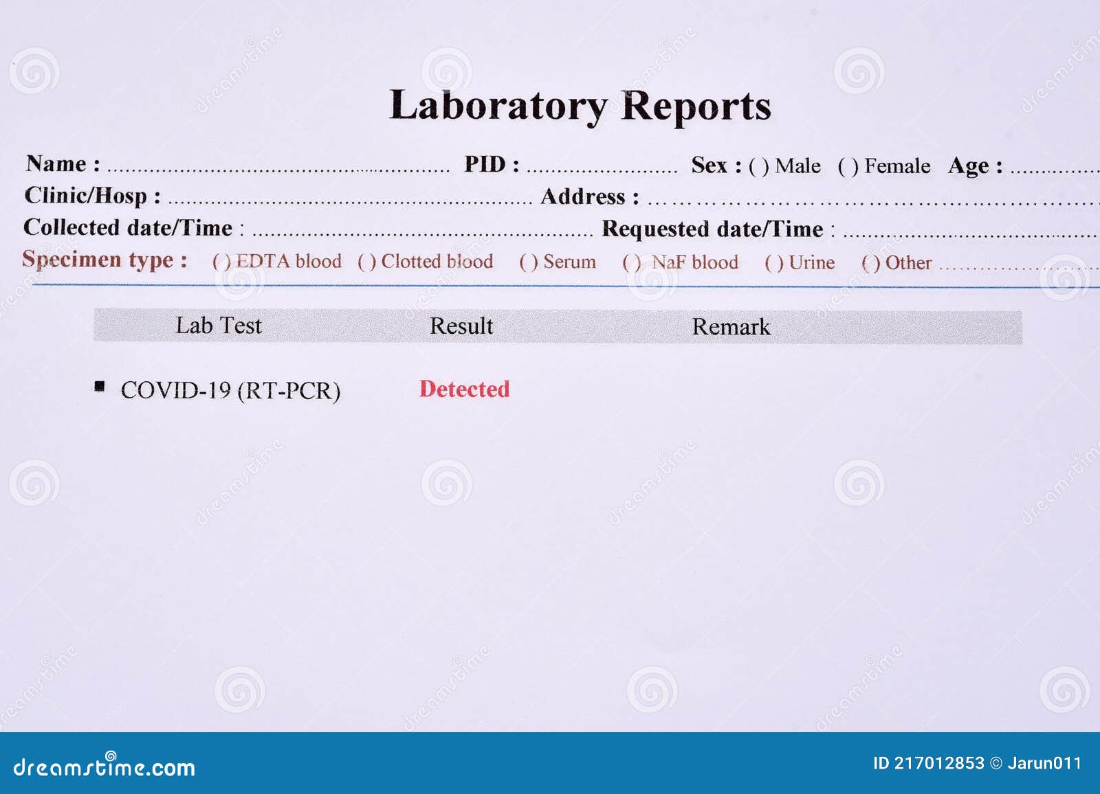 COVID-19 detected result stock image. Image of positive - 217012853