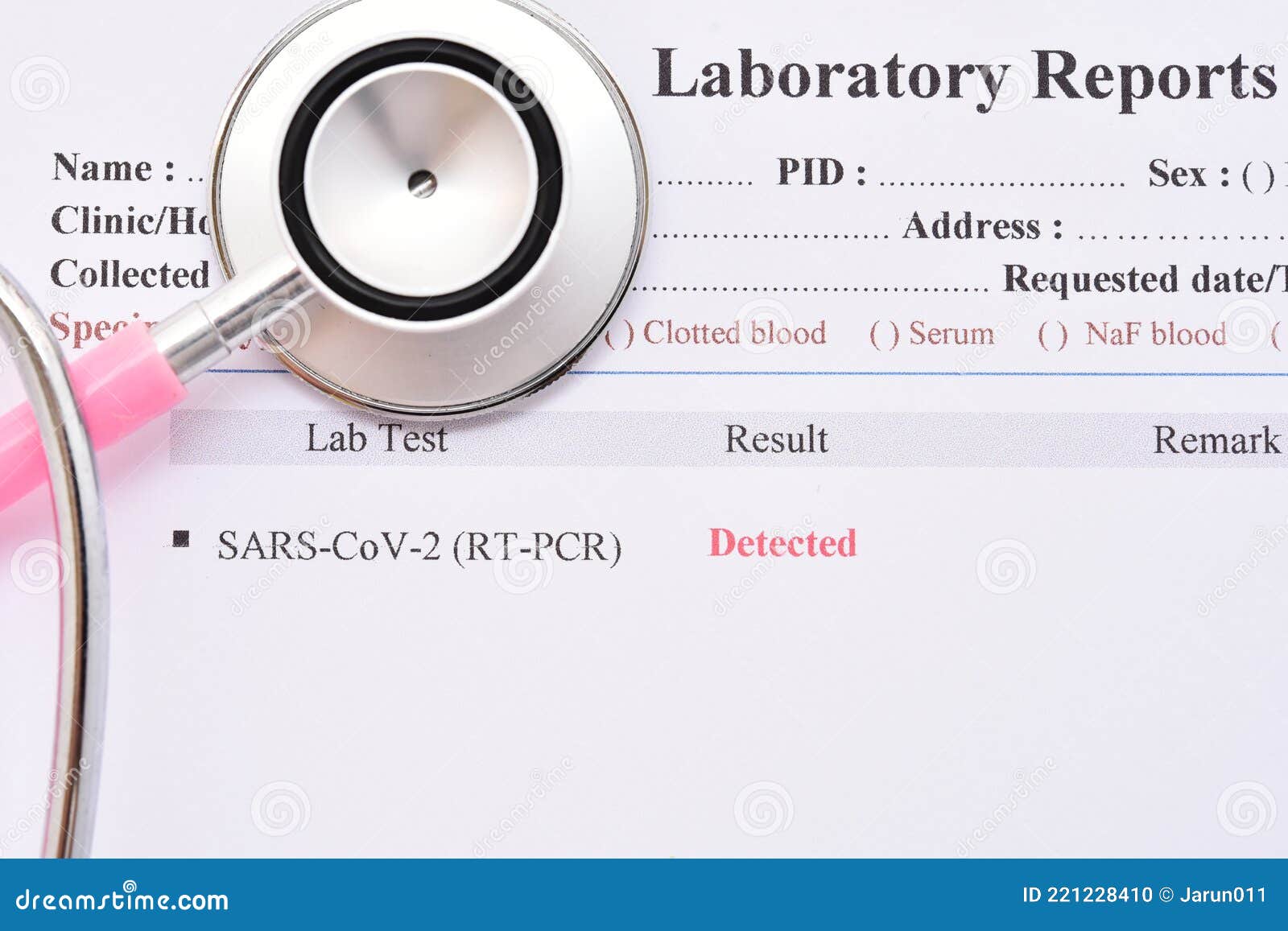 COVID-19 Detected Result by Using RT-PCR Method Stock Photo - Image of ...