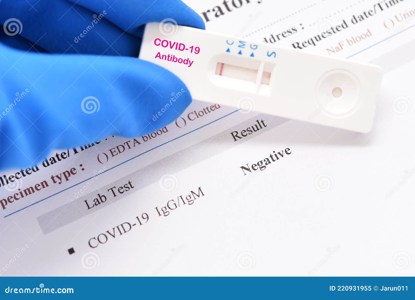 COVID-19 IgG/IgM Antibody Negative Result by Using Rapid Card Test ...