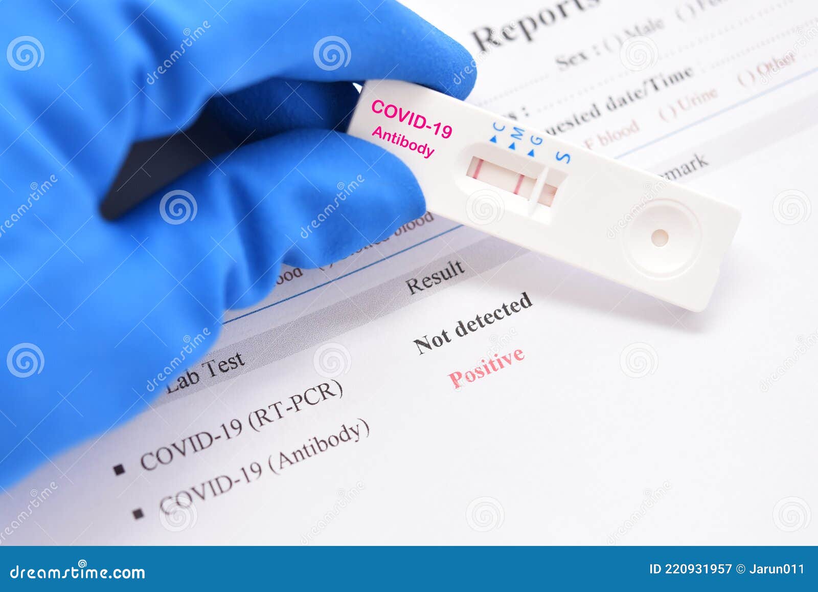 COVID-19 Negative Result by RT-PCR Method but Positive by Rapid Test ...