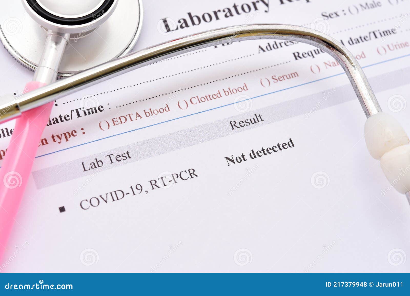 COVID-19 Not Detected Result, Laboratory Report of COVID-19 Testing by ...
