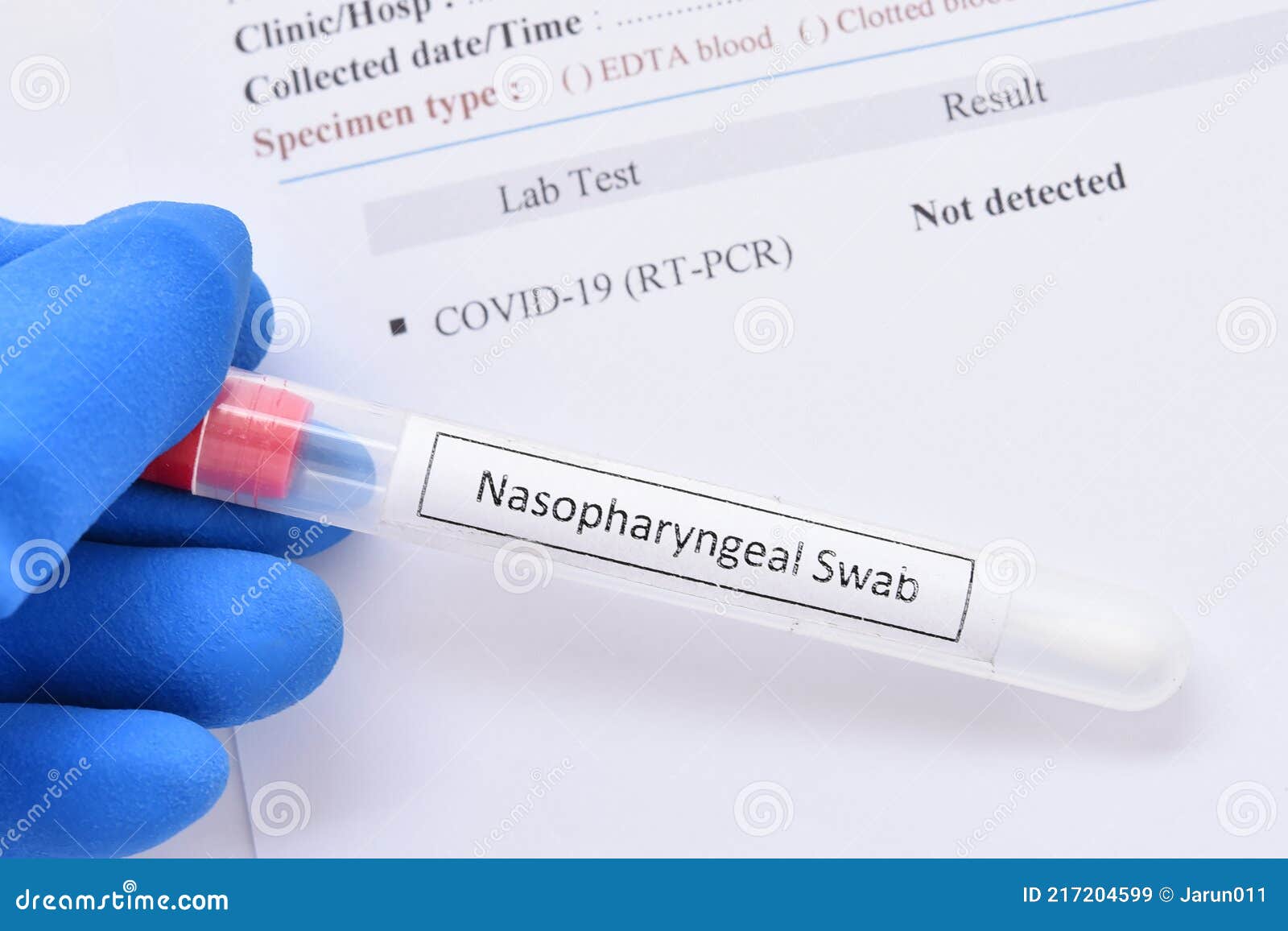 COVID-19 Not Detected Result by Using RT-PCR Method Stock Image - Image ...