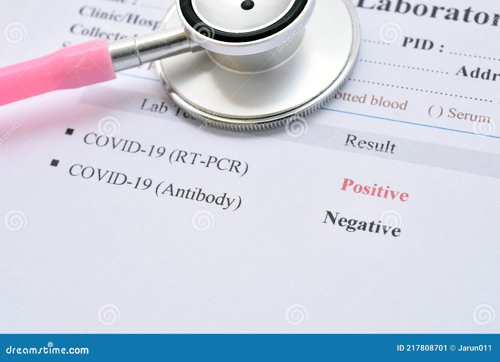 COVID-19 Positive and Negative Test Results Stock Image - Image of ...