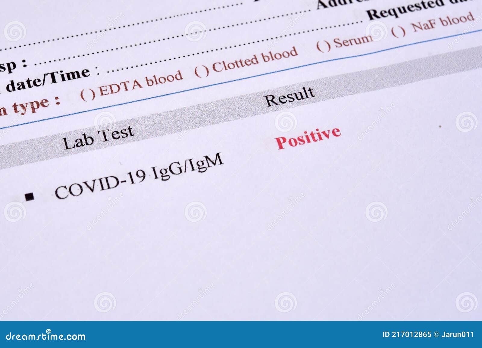 COVID-19 positive result stock image. Image of permit - 217012865