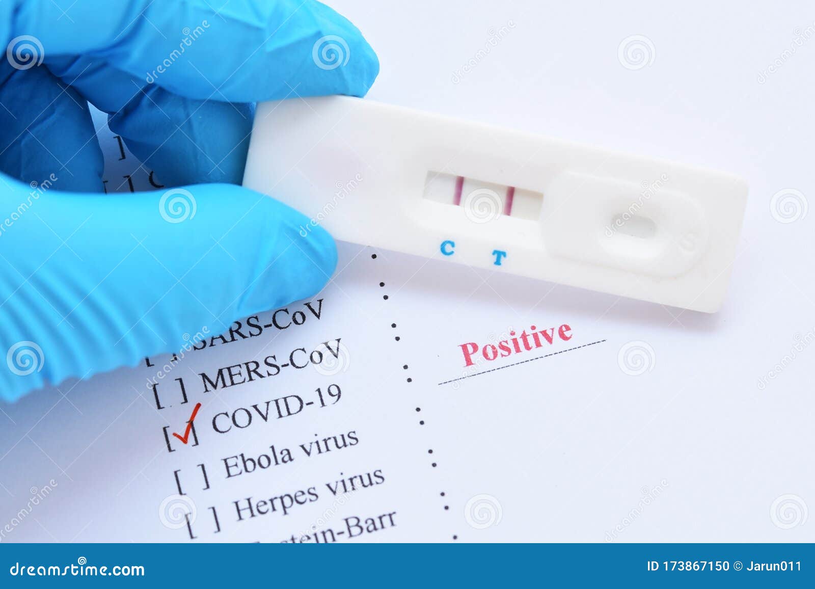 COVID-19 positive result stock photo. Image of analyzing - 173867150