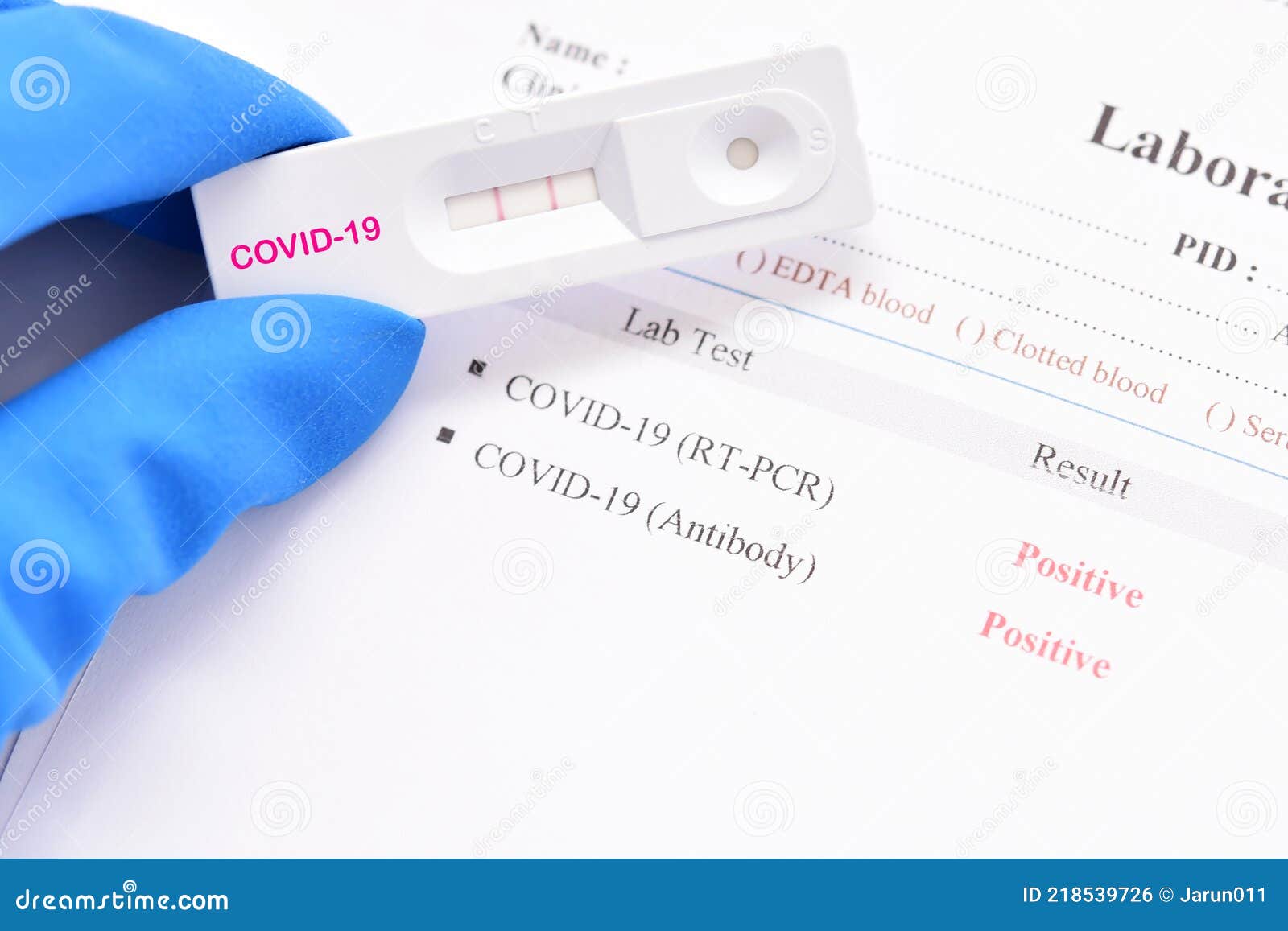 COVID-19 Positive Results by Using RT-PCR Method and Rapid Test ...