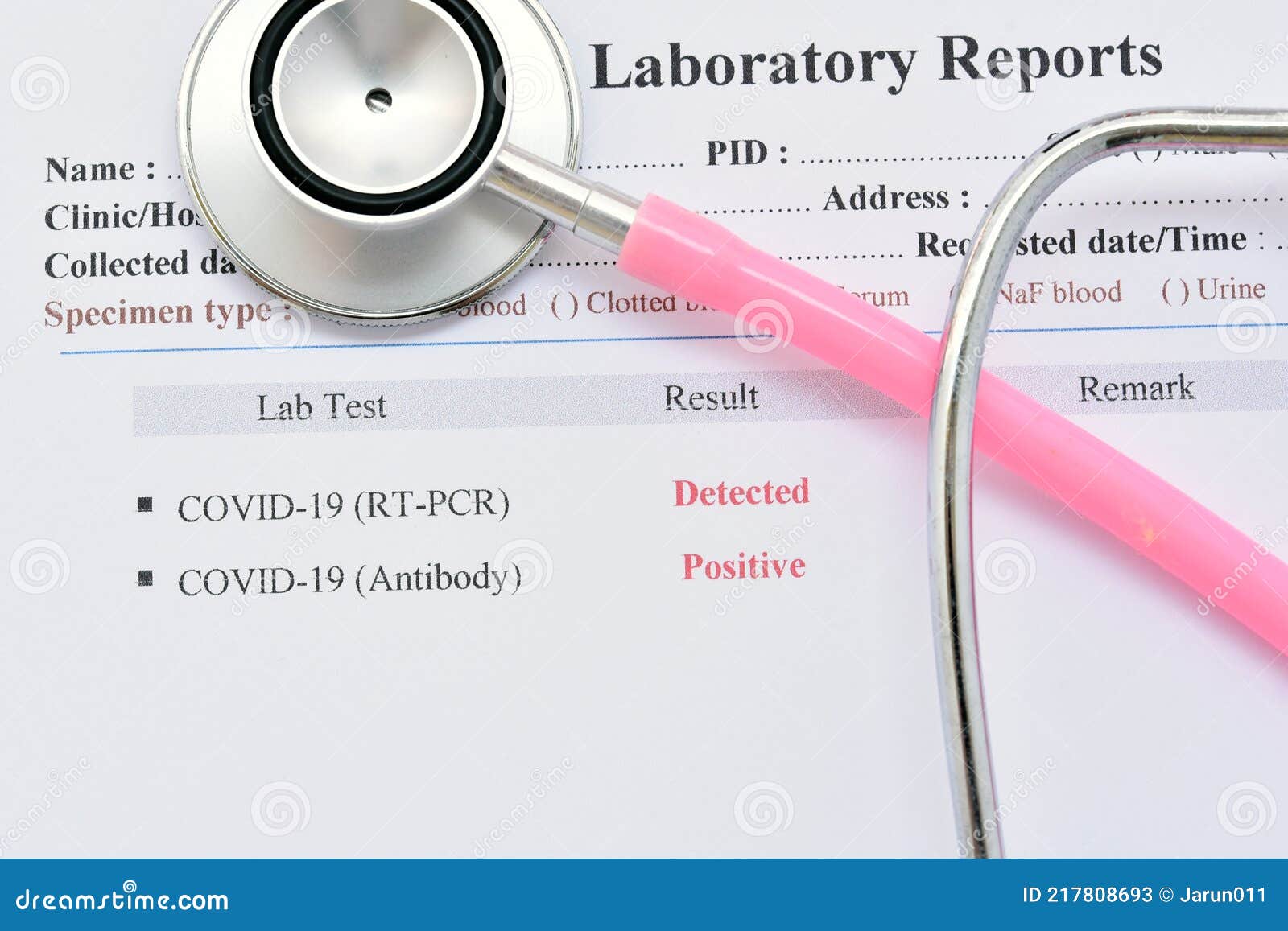 COVID-19 Positive Test Results by Using RT-PCR Method and Rapid Test ...