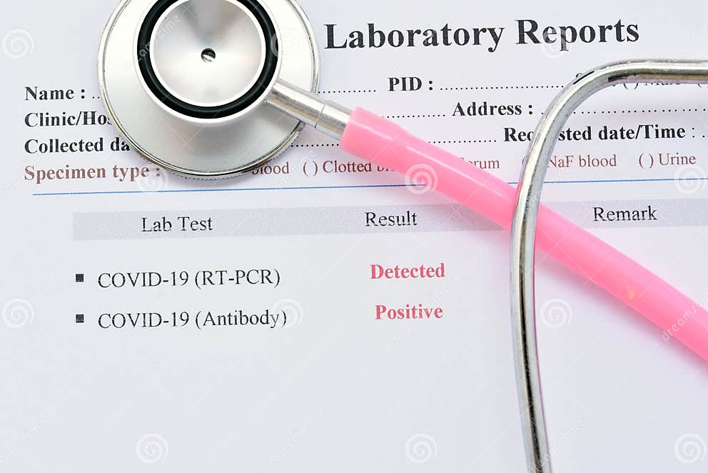 COVID-19 Positive Test Results by Using RT-PCR Method and Rapid Test ...