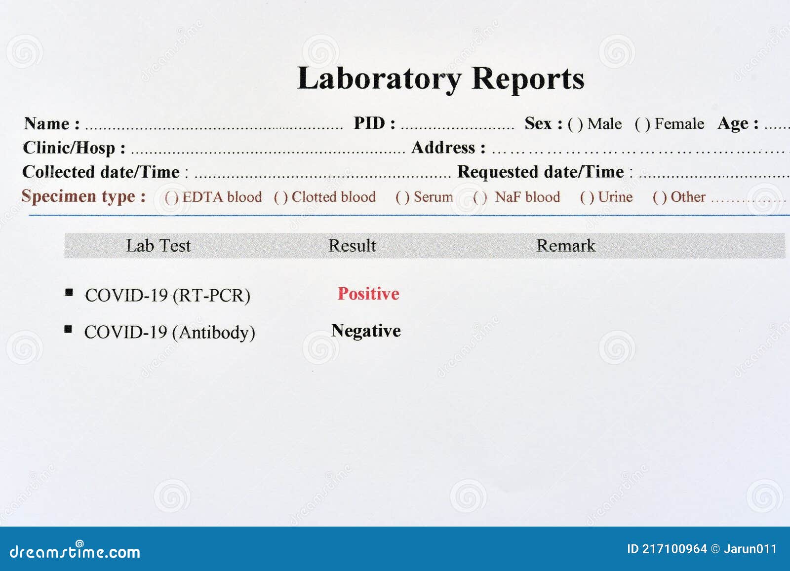 Positive Test Result By Using Rapid Test For COVID-19, Quick Fast ...