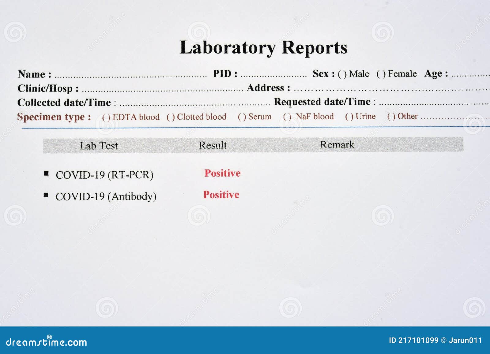 COVID-19 Positive Test Results Stock Image - Image of gene, blood ...