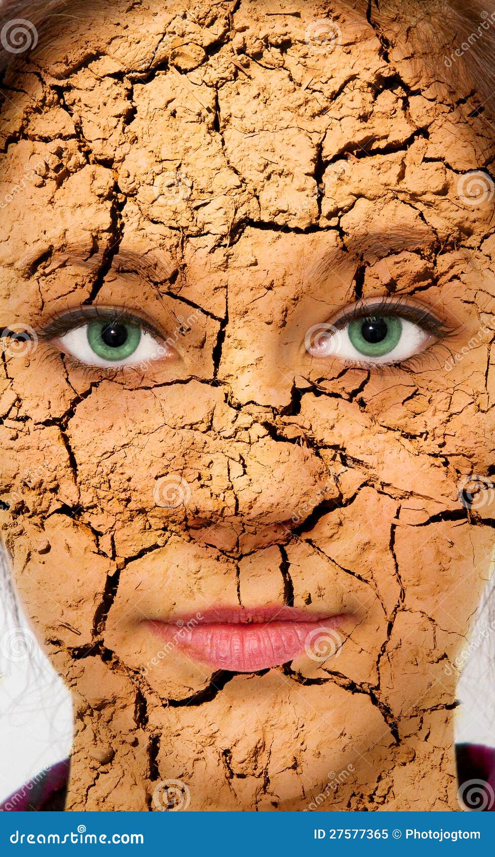 Cracked Skin stock image. Image of face, dermatologist - 27577365