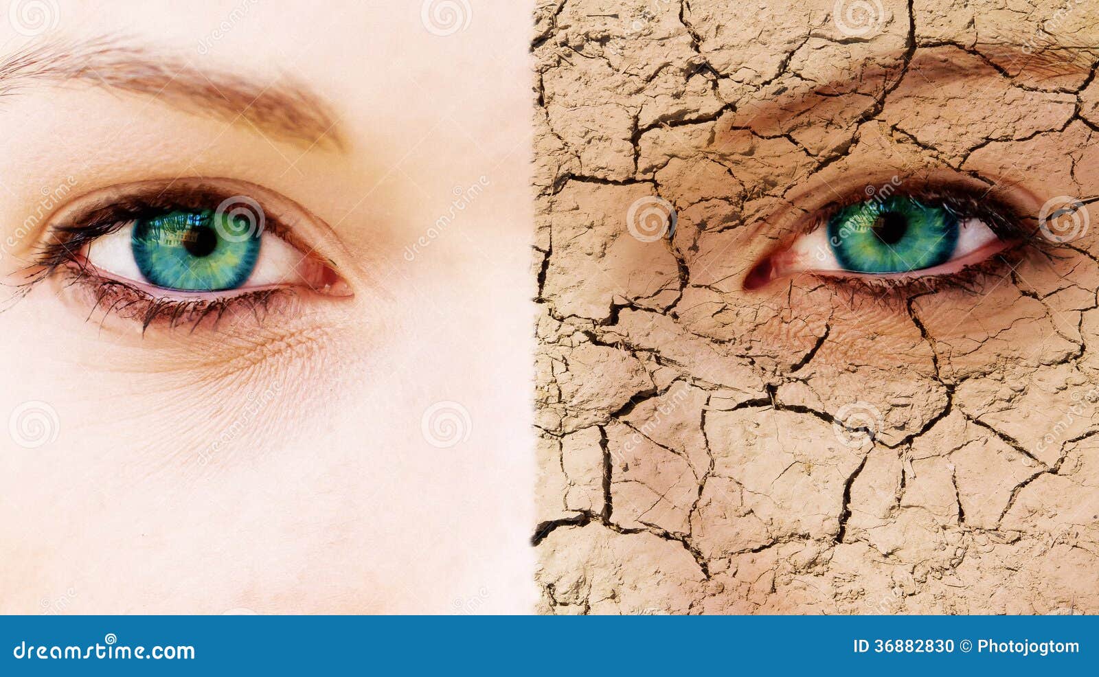 Cracked skin stock photo. Image of artistic, close, closeup - 36882830