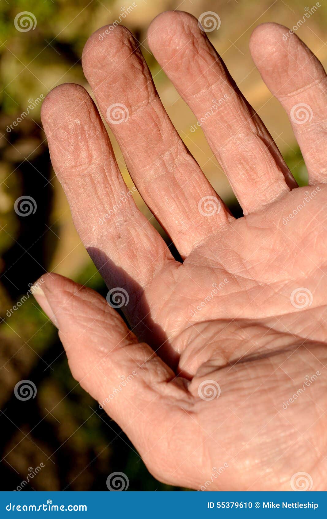Cracked Skin on a Workman S Hand Stock Photo - Image of hard ...