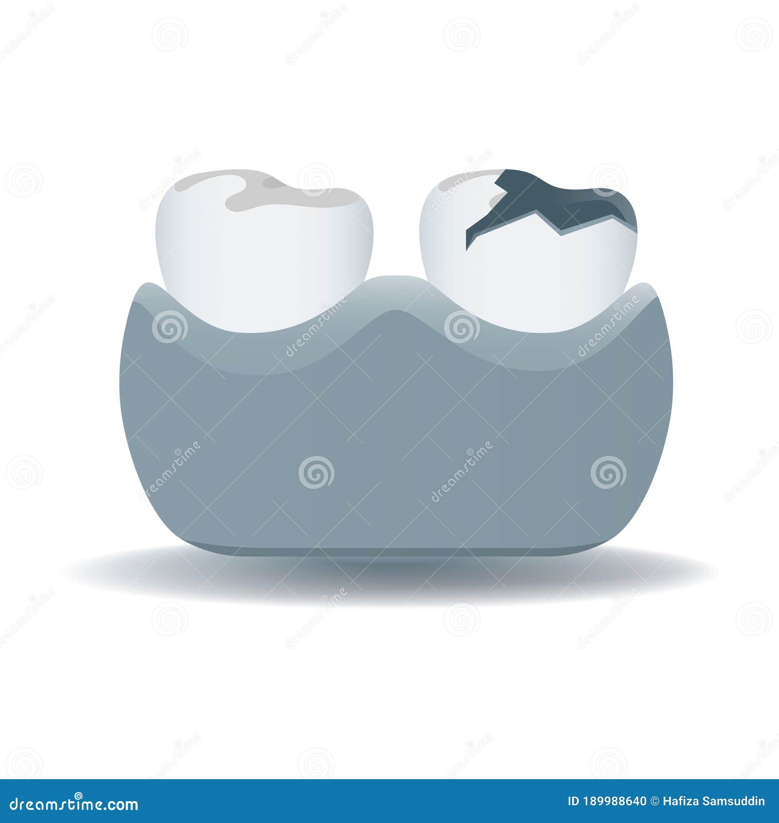 Cracked Tooth. Vector Illustration Decorative Design Stock Vector ...