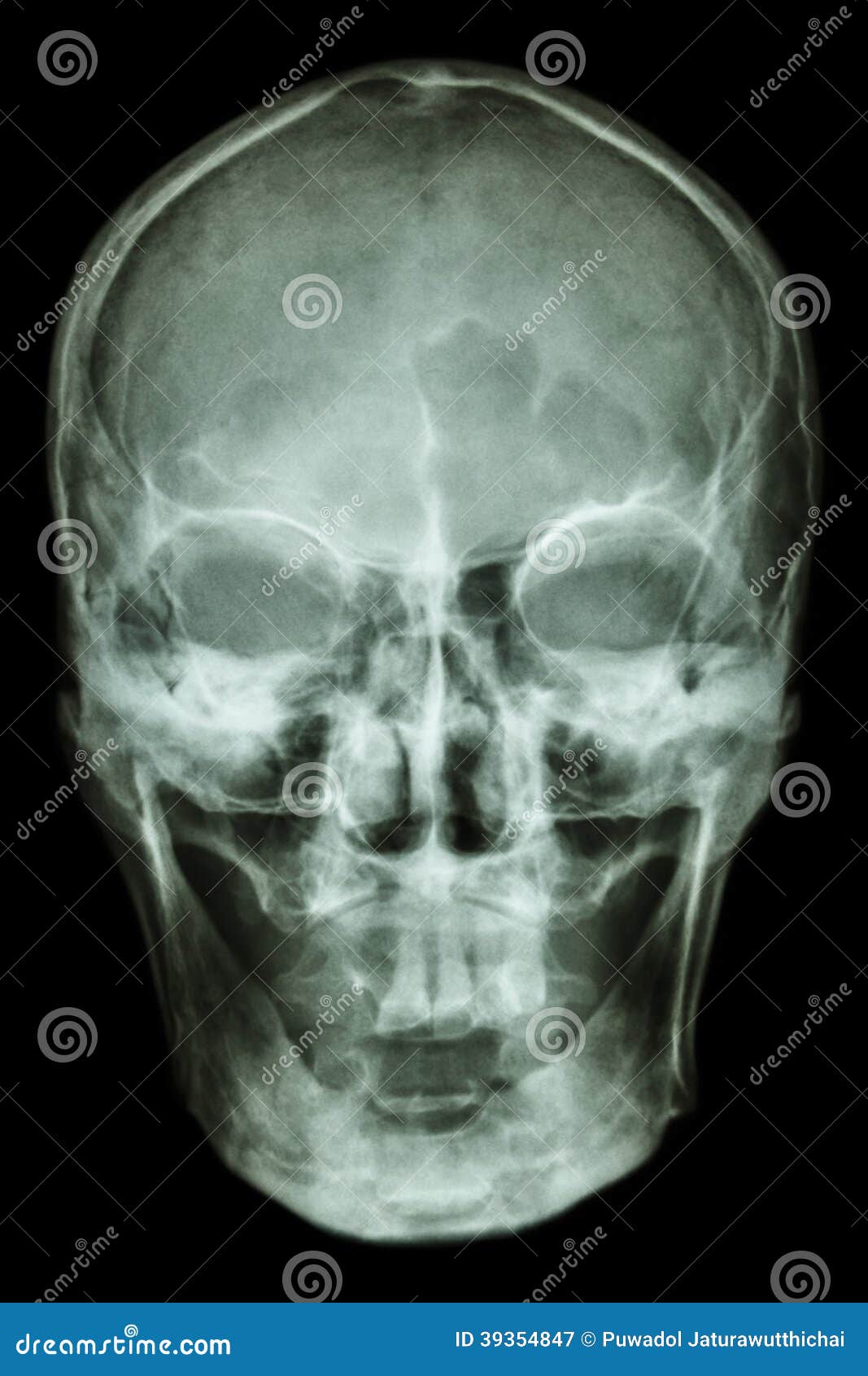 Cranio umano normale immagine stock. Immagine di salute - 39354847