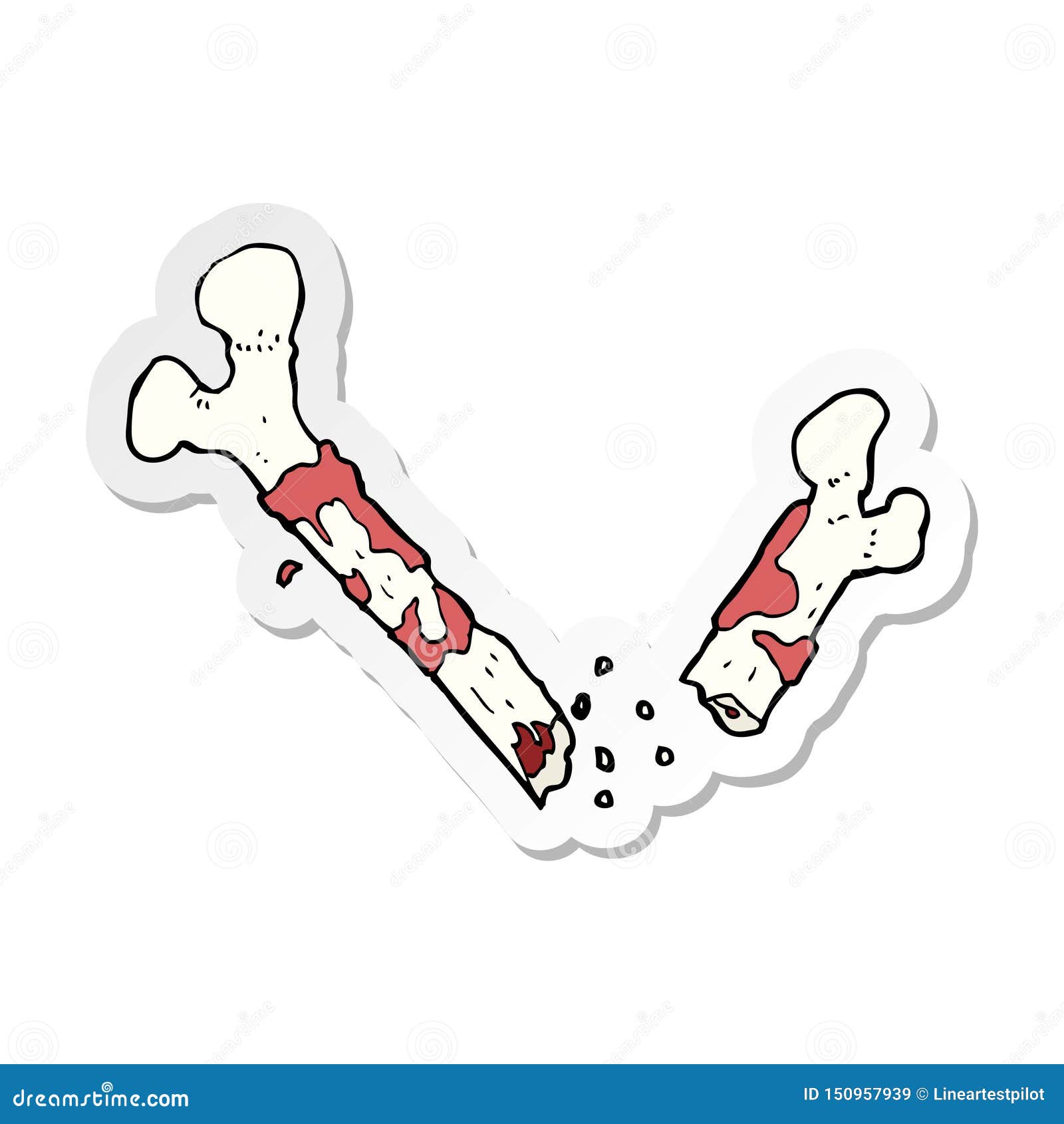 A Creative Sticker of a Gross Broken Bone Cartoon Stock Vector ...
