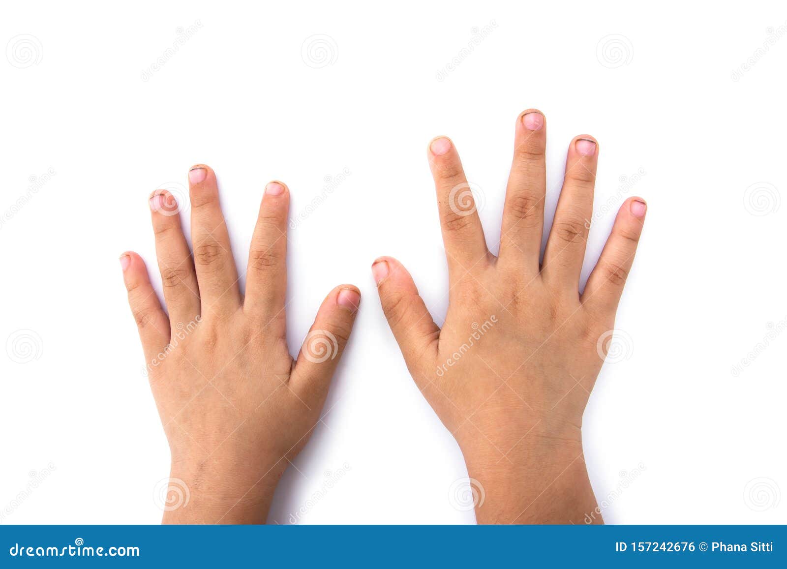 Crianças Sujas Unhas E Mãos Isoladas Sobre Fundo Branco Unhas Sujas ...