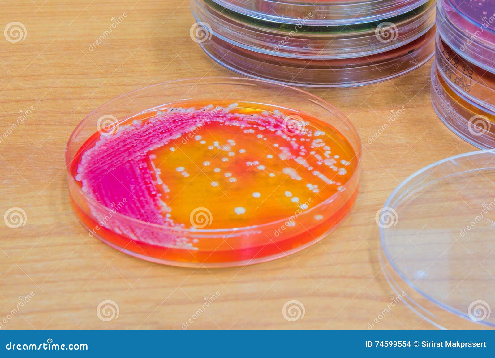 Croissance Bactérienne De Culture De Plat D'agar Photo stock - Image du ...